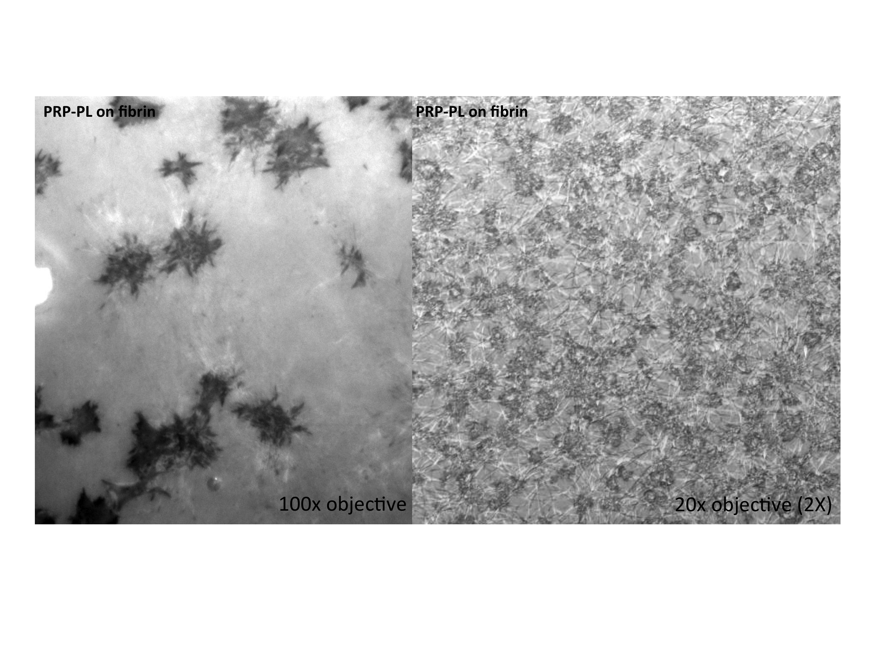 fibrinogen and platelets difference
