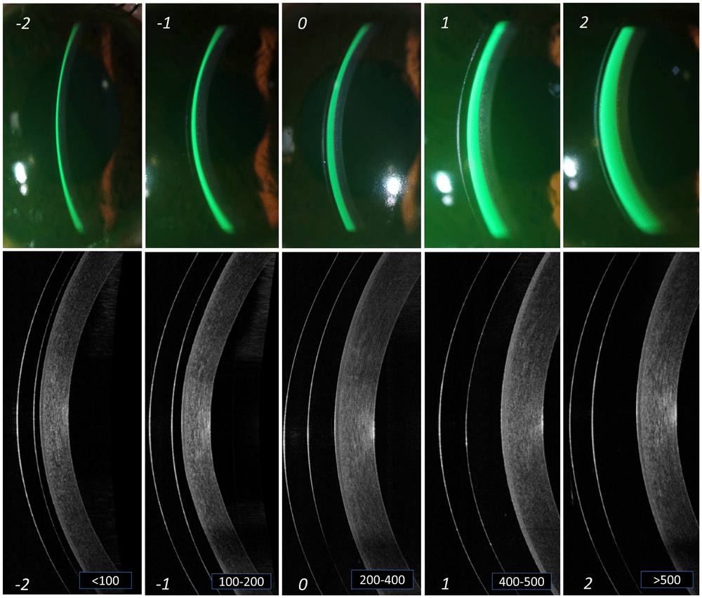 A multi-parameter grading system for optimal... | F1000Research