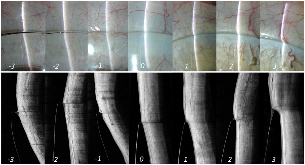 A multi-parameter grading system for optimal... | F1000Research