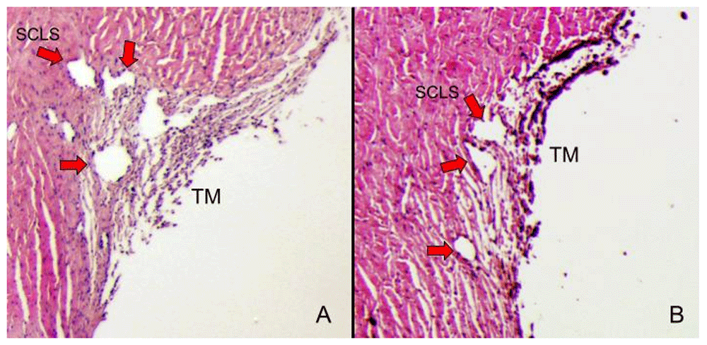 Impact of freeze-thaw cytoablation on aqueous... | F1000Research