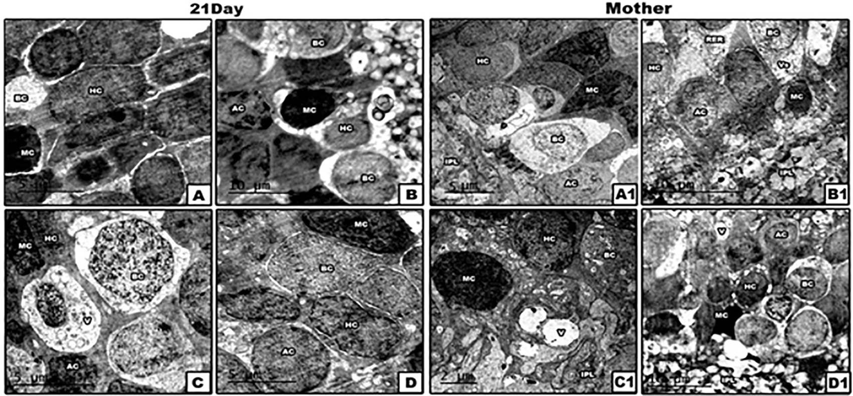 Evaluation of lead toxicity on the retina of... | F1000Research