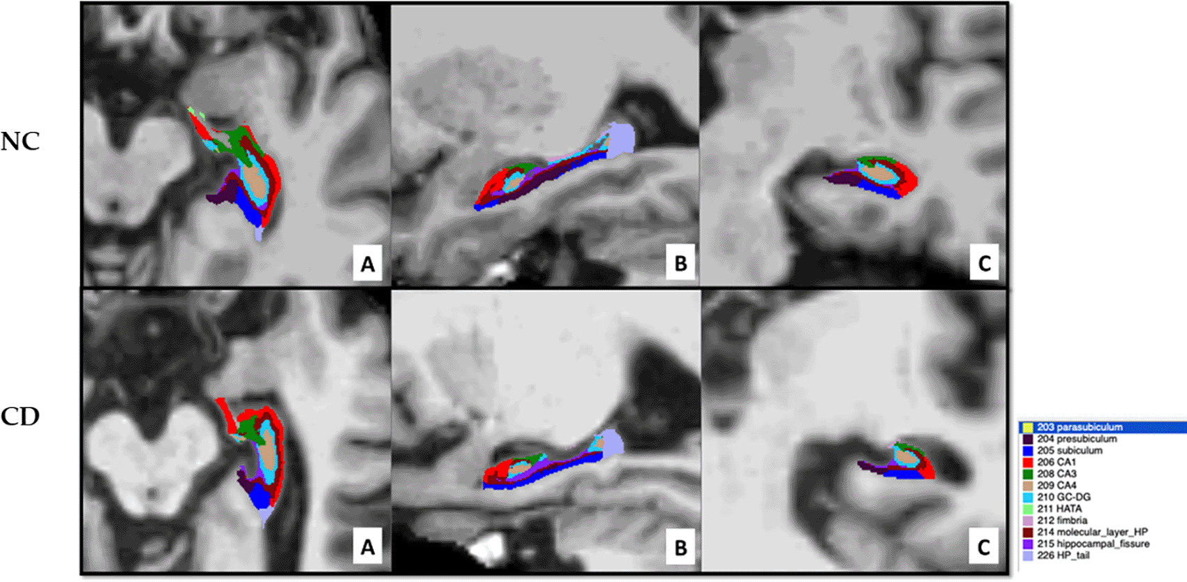 Sulfiredoxin-1 blood mRNA expression levels... | F1000Research