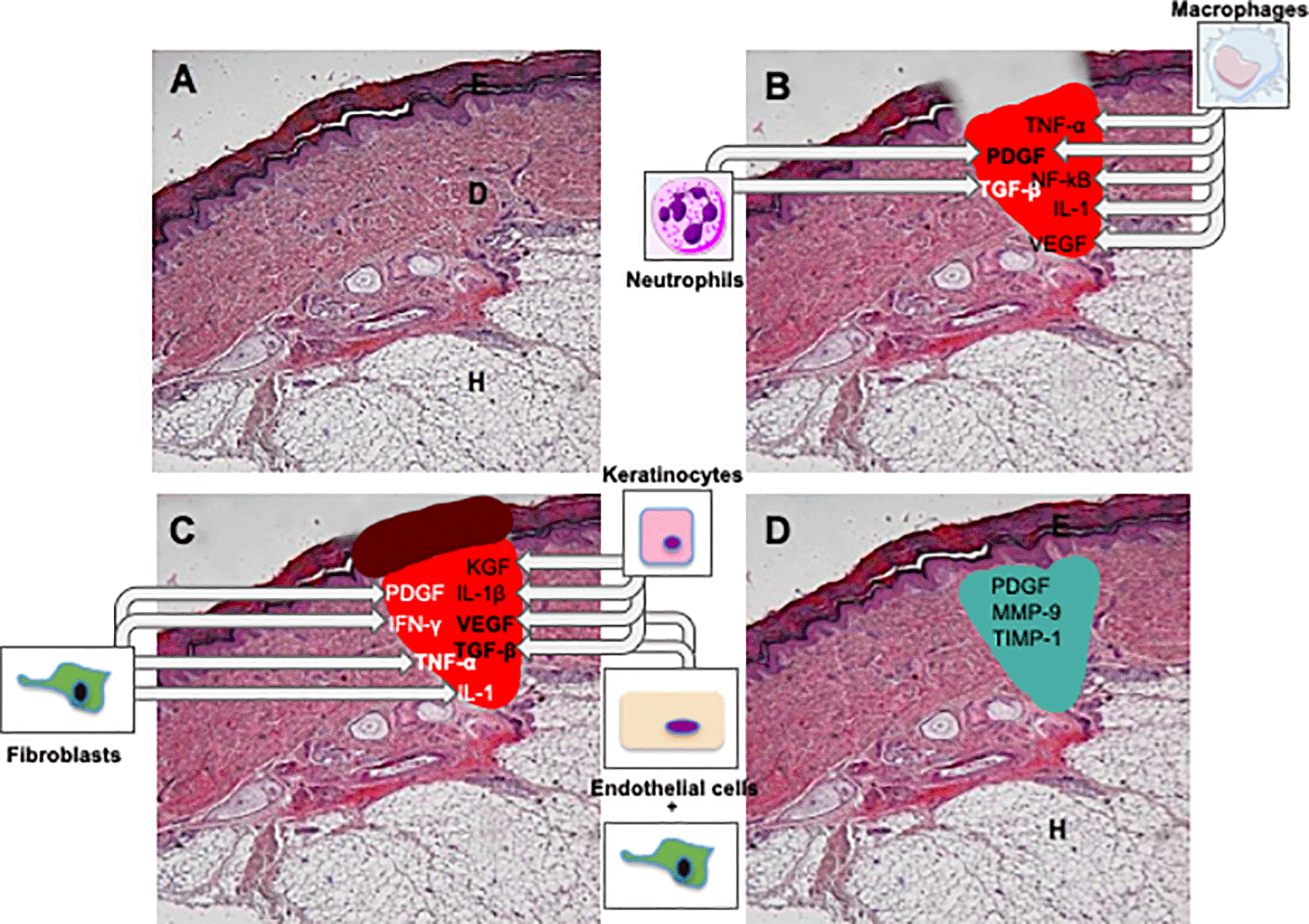 Molecular mediators involved in skin healing: a... | F1000Research