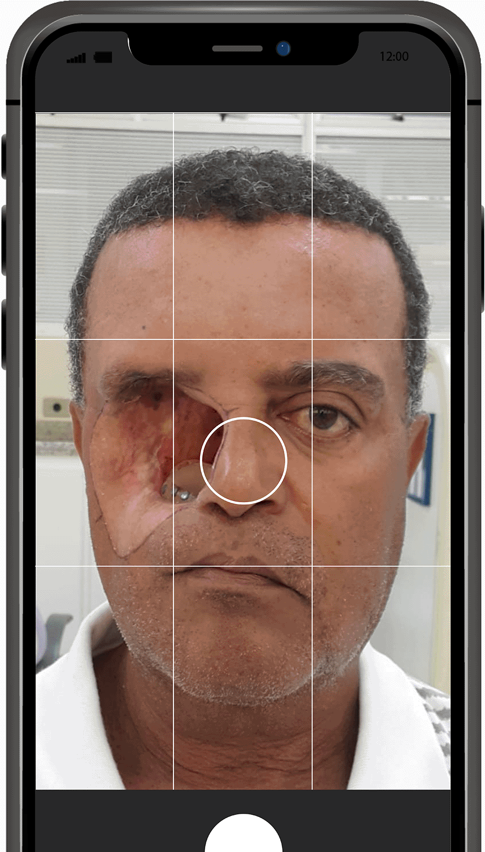 Color translation from monoscopic photogrammetry... | F1000Research