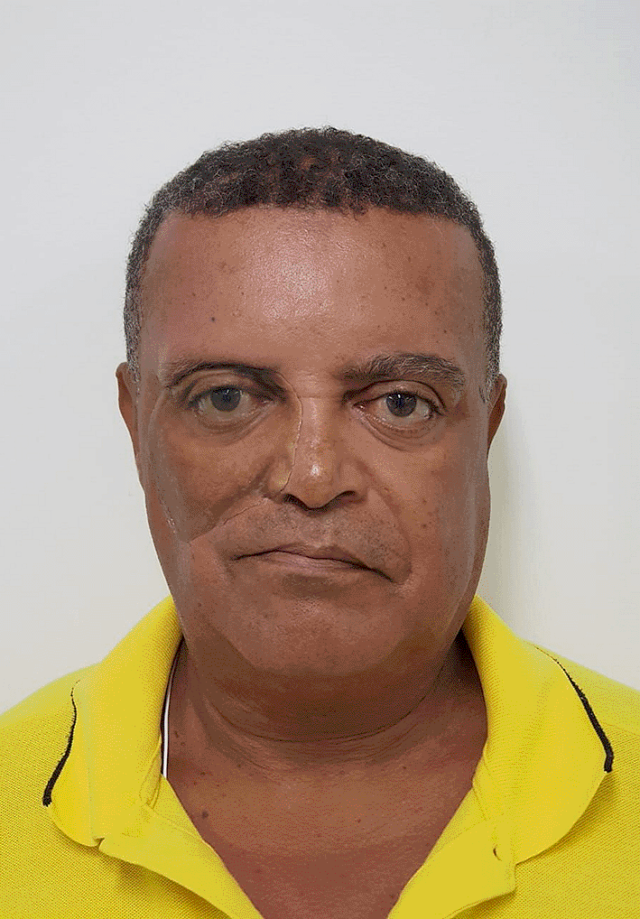 Color translation from monoscopic photogrammetry... | F1000Research