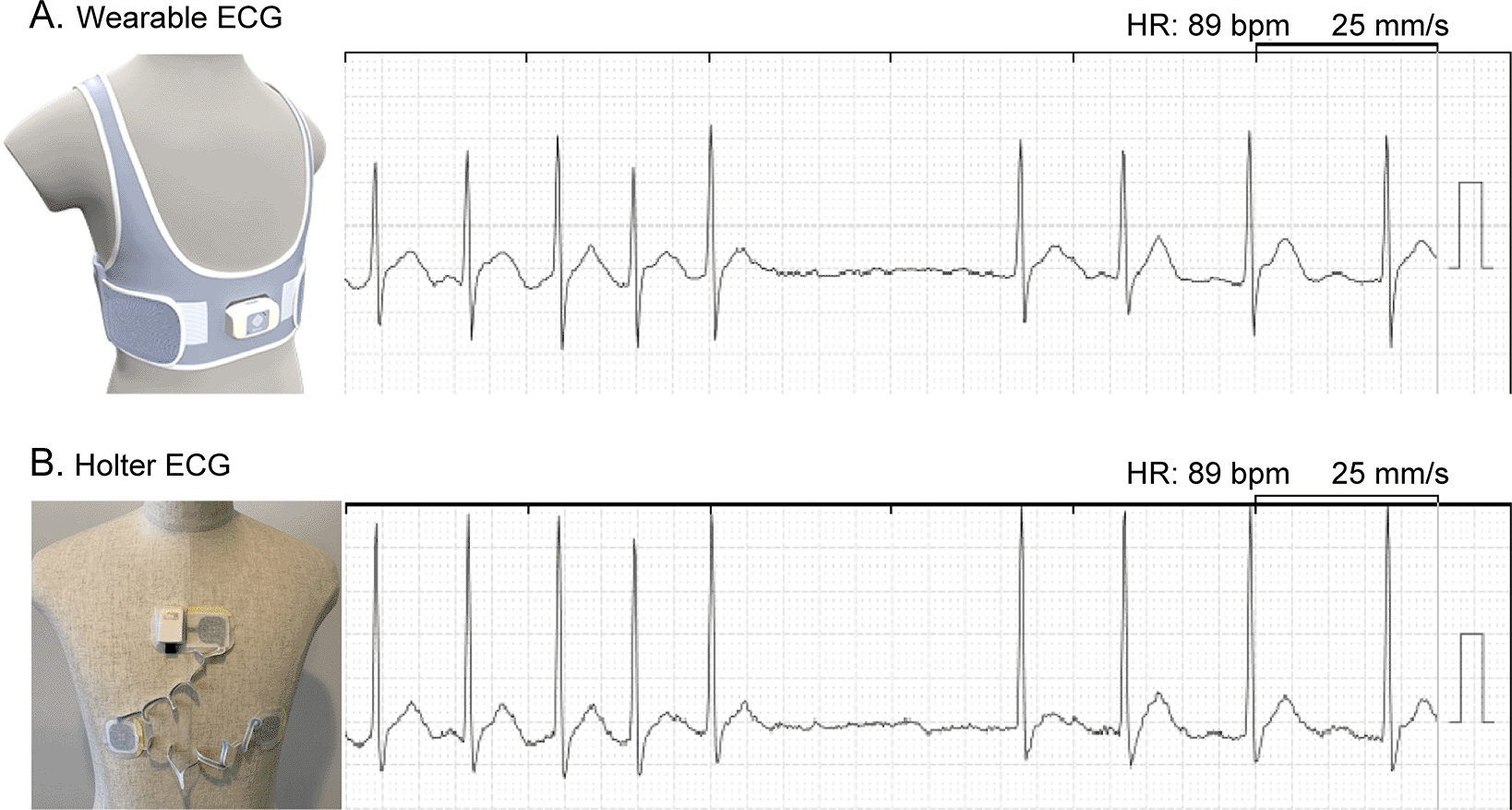 Dry textile electrode for ambulatory monitoring... | F1000Research