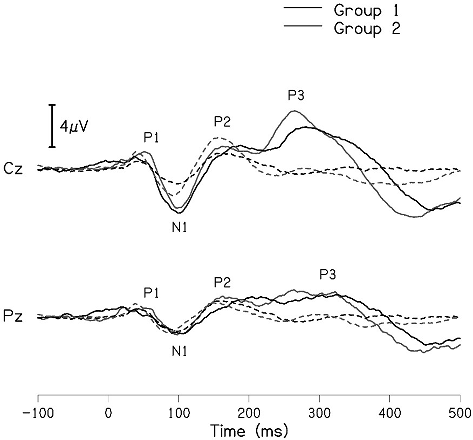 Cortical auditory potentials and cognitive... | F1000Research