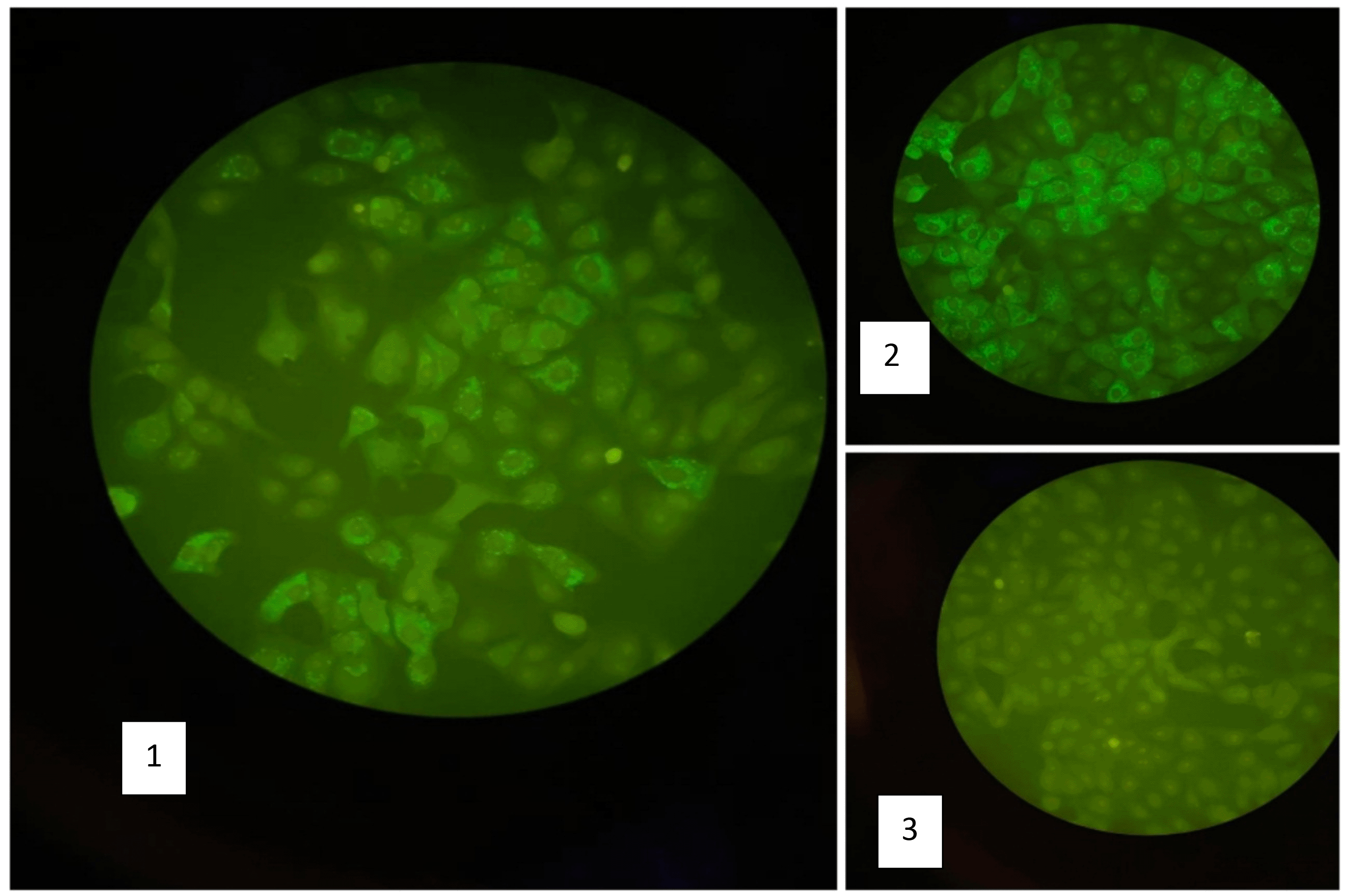 Transmission of yellow fever vaccine virus from... | F1000Research