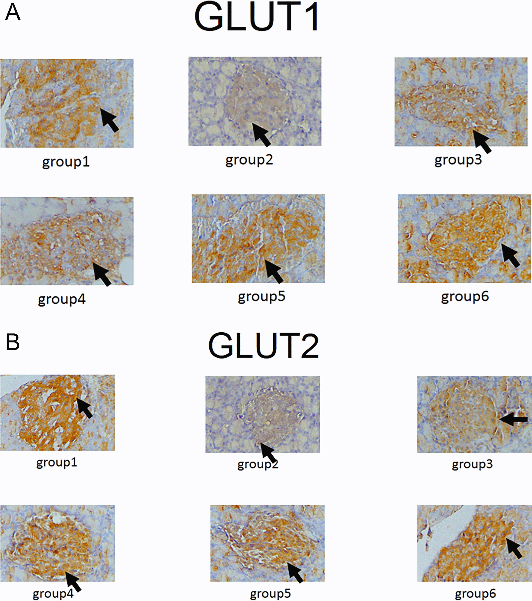 DLBS3233 reduces inflammatory marker on kidney by... | F1000Research