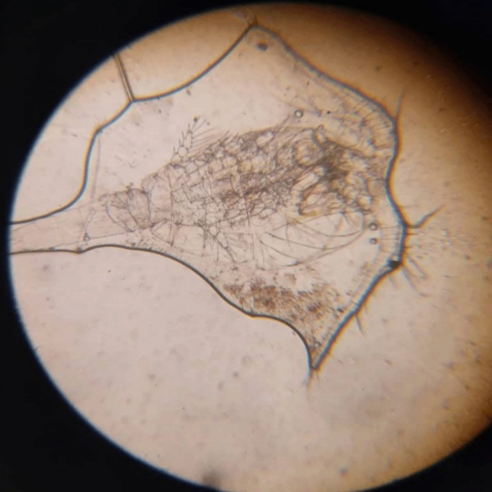 Detection and identification of cyclops in... | F1000Research