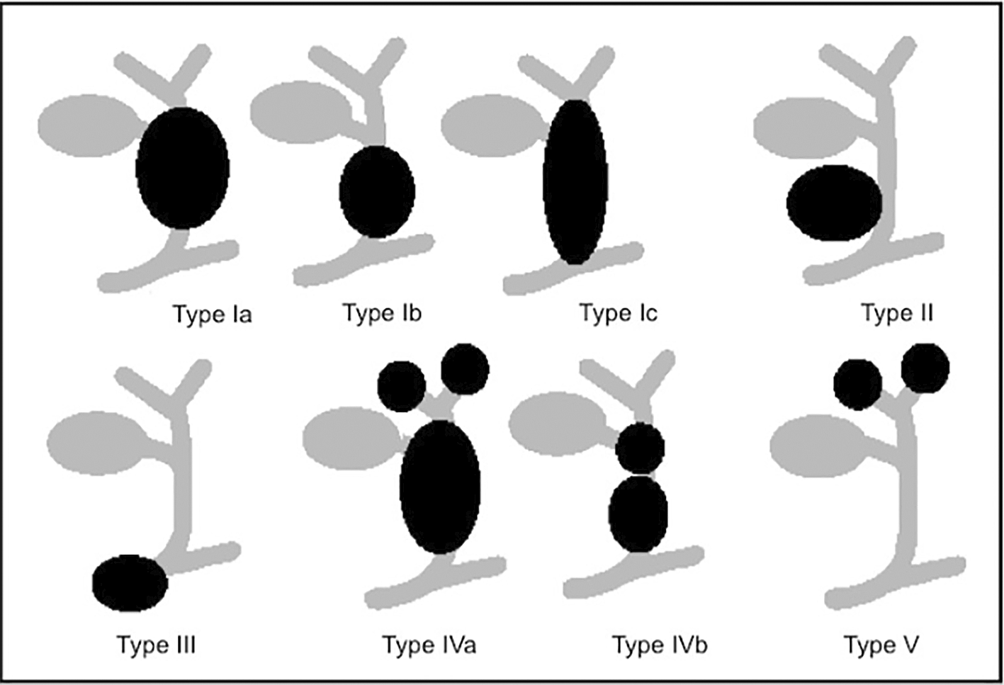 Case Report: A rare case of choledochal cyst | F1000Research
