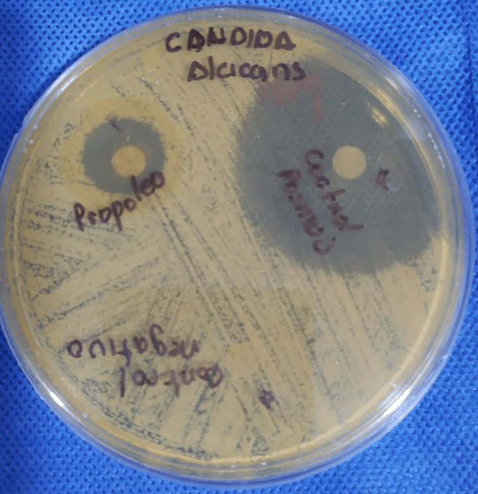 Antifungal activity of propolis extract against... | F1000Research