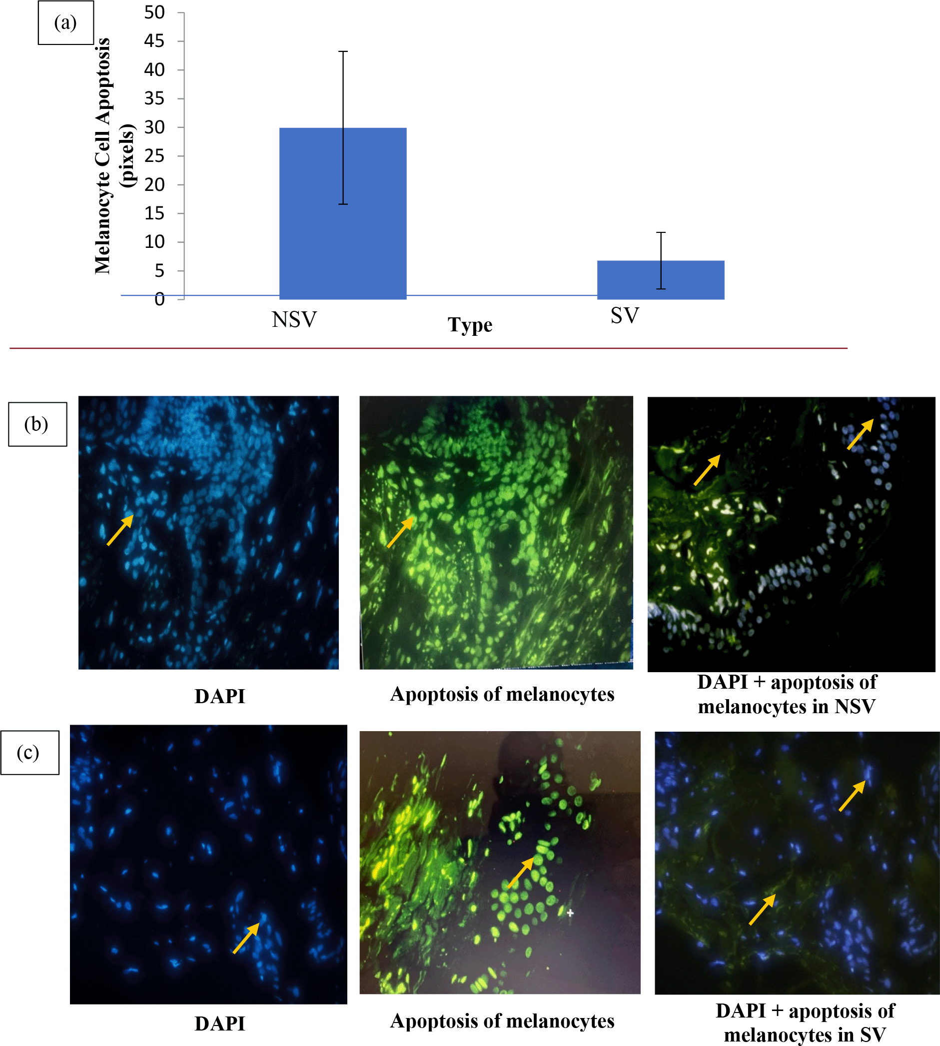 Melan-A expression related to apoptosis of... | F1000Research