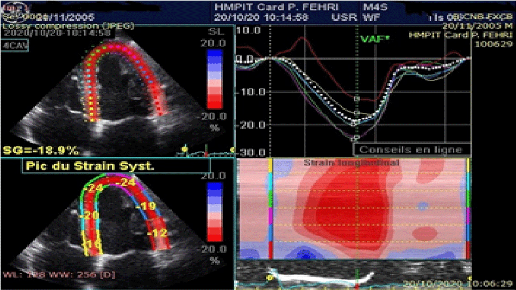 Evaluation of left ventricular systolic function in... | F1000Research