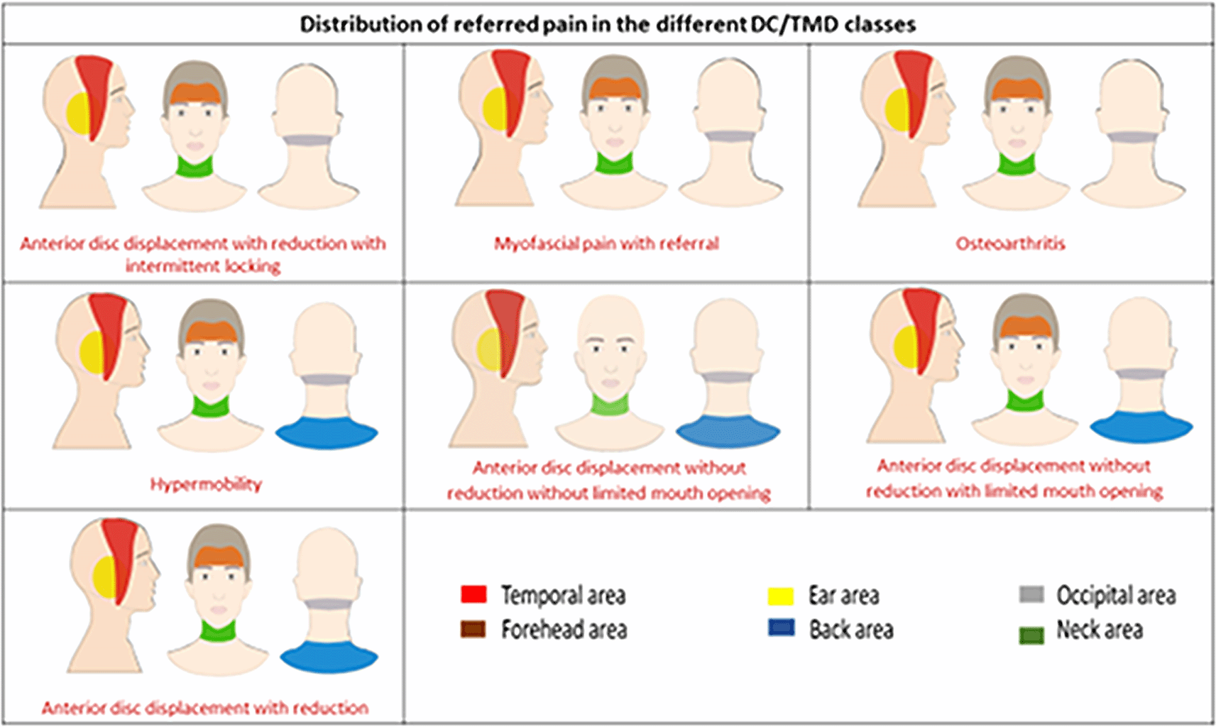 Prevalence and characteristics of referred pain... | F1000Research
