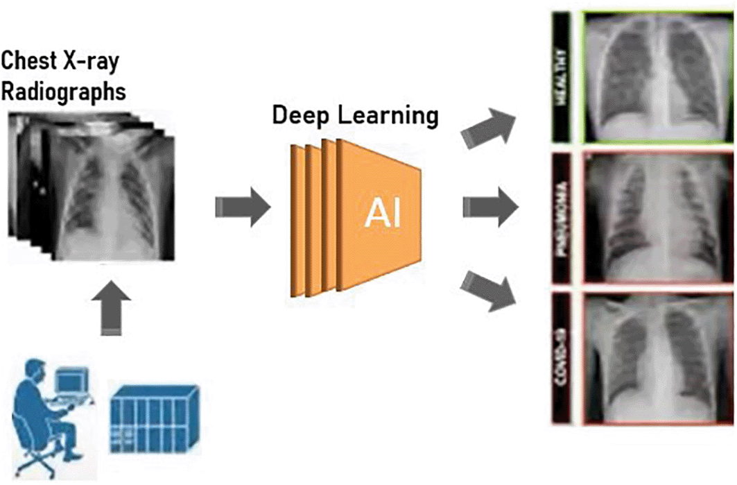 Application of Fuzzy Deep Neural Networks for Covid... | F1000Research