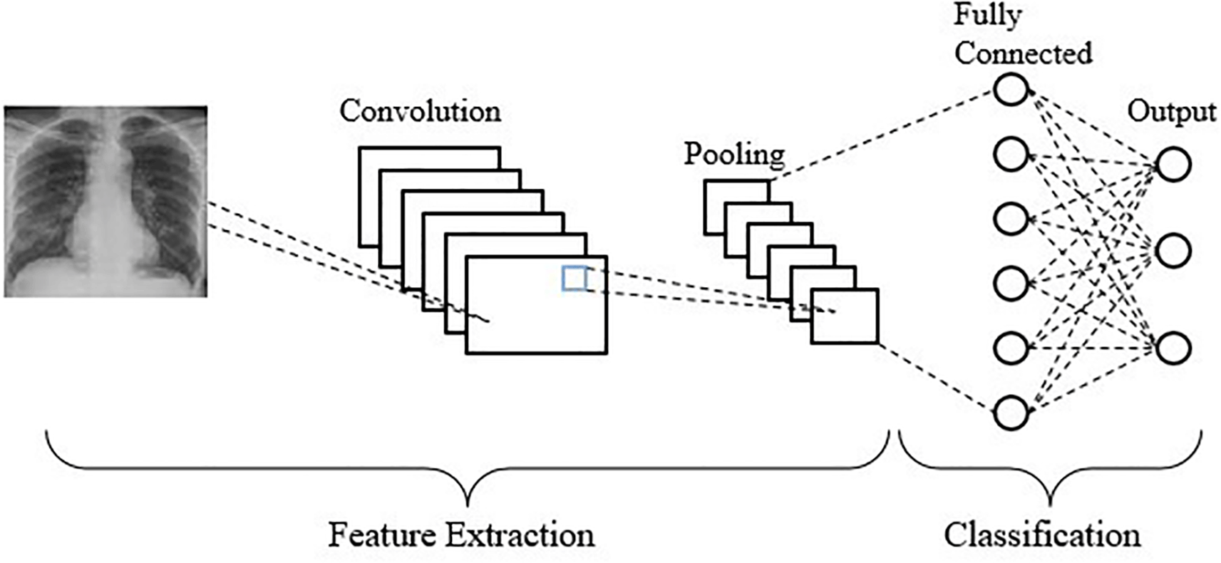 Application of Fuzzy Deep Neural Networks for Covid... | F1000Research
