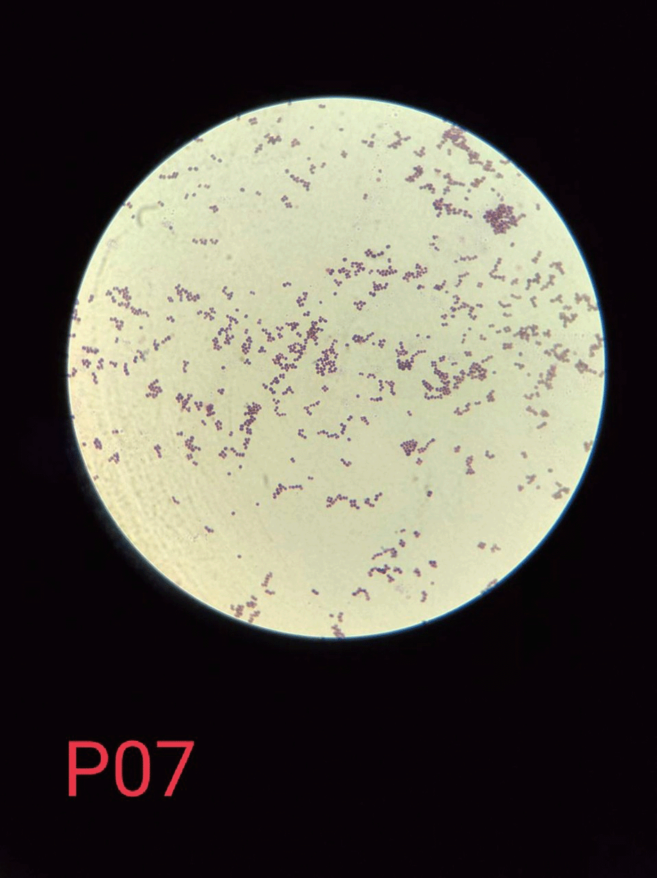 Detection of mecA gene and methicillin-resistant... | F1000Research