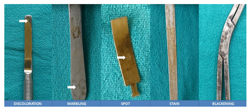 A pilot study comparing pattern of damage sustained... | F1000Research