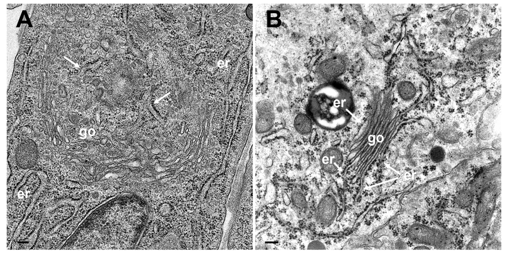 Golgi Apparatus Electron Micrograph