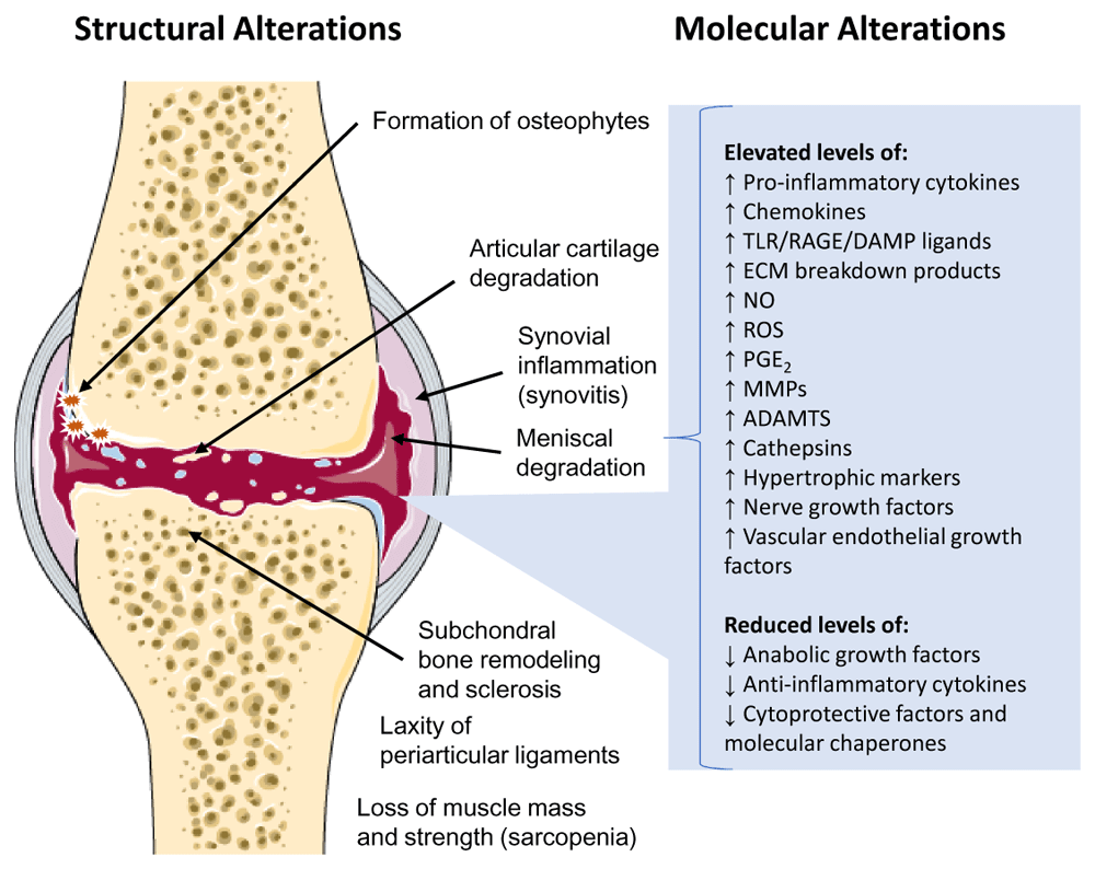 Recent advances in understanding the phenotypes... | F1000Research
