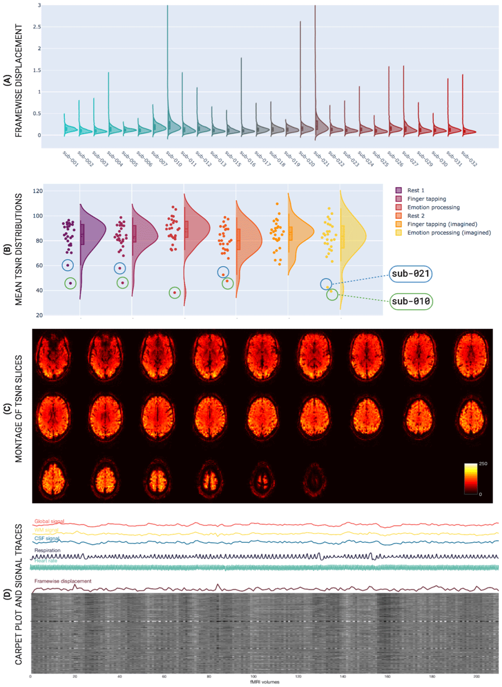rt-me-fMRI: a task and resting state dataset for... | F1000Research