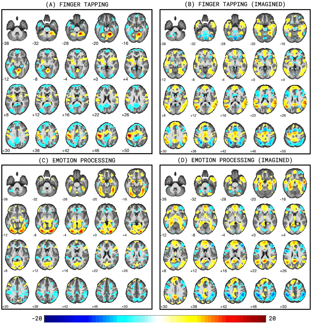 rt-me-fMRI: a task and resting state dataset for... | F1000Research