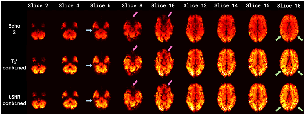 rt-me-fMRI: a task and resting state dataset for... | F1000Research