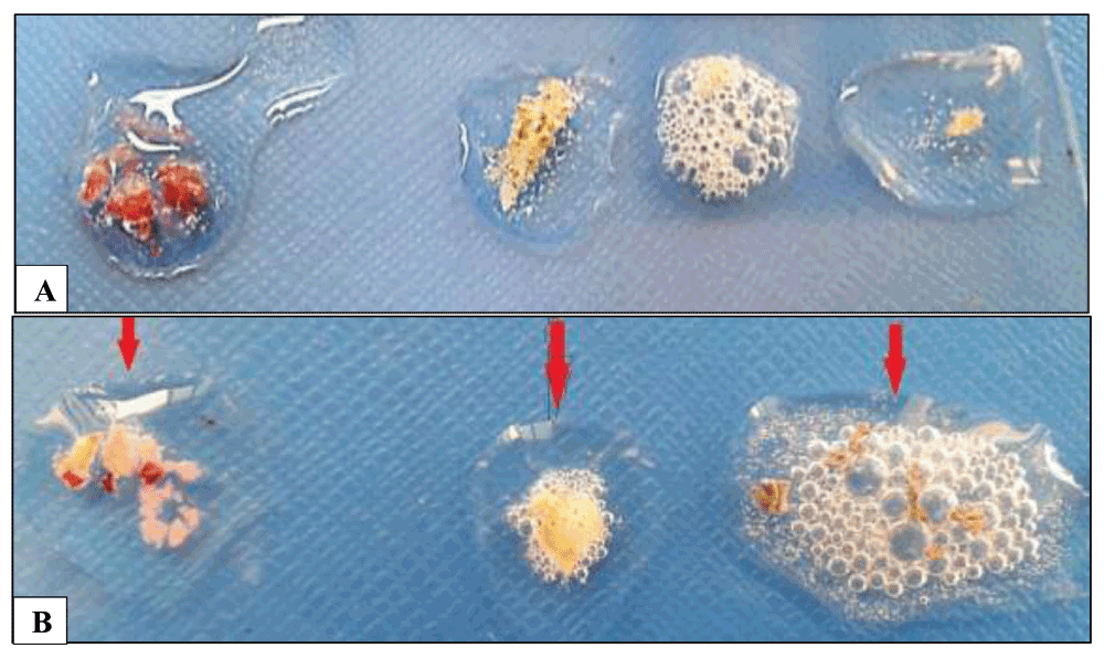 A new record of Actinobacteria isolated from soil... | F1000Research