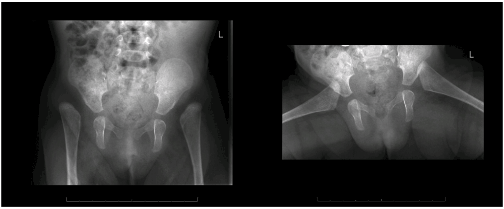 Essential timing of orthopaedic treatment in... | F1000Research