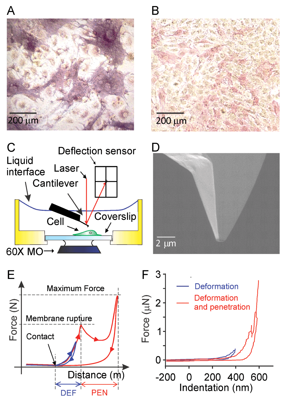 Local membrane deformation and micro-injury lead to... | F1000Research