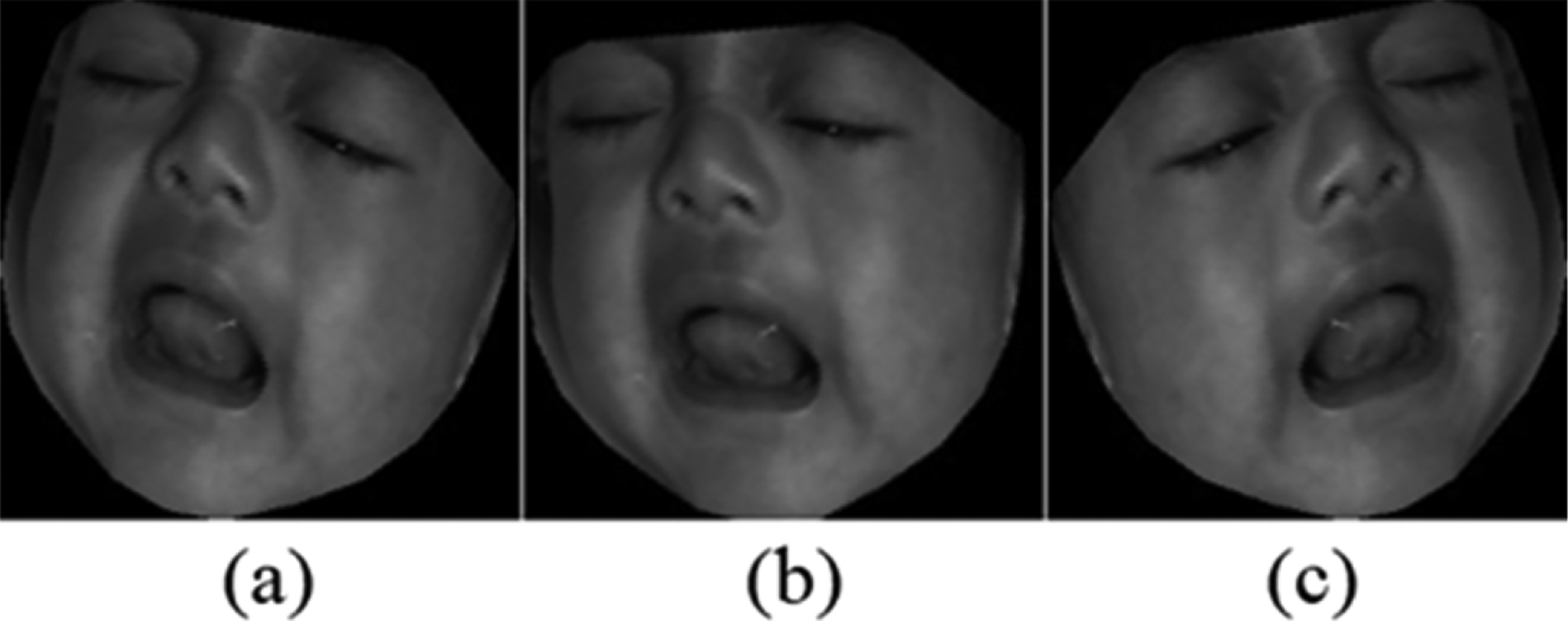 Ensemble of multimodal deep learning autoencoder... | F1000Research