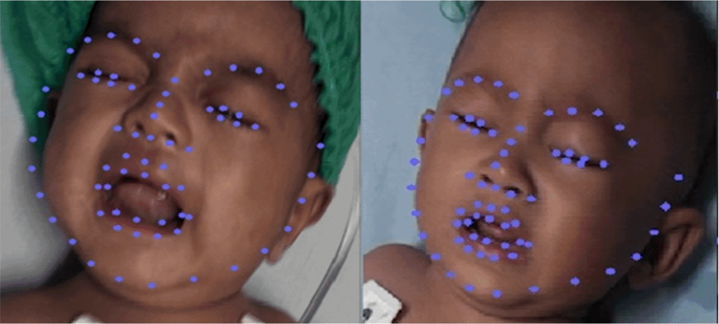 Ensemble of multimodal deep learning autoencoder... | F1000Research