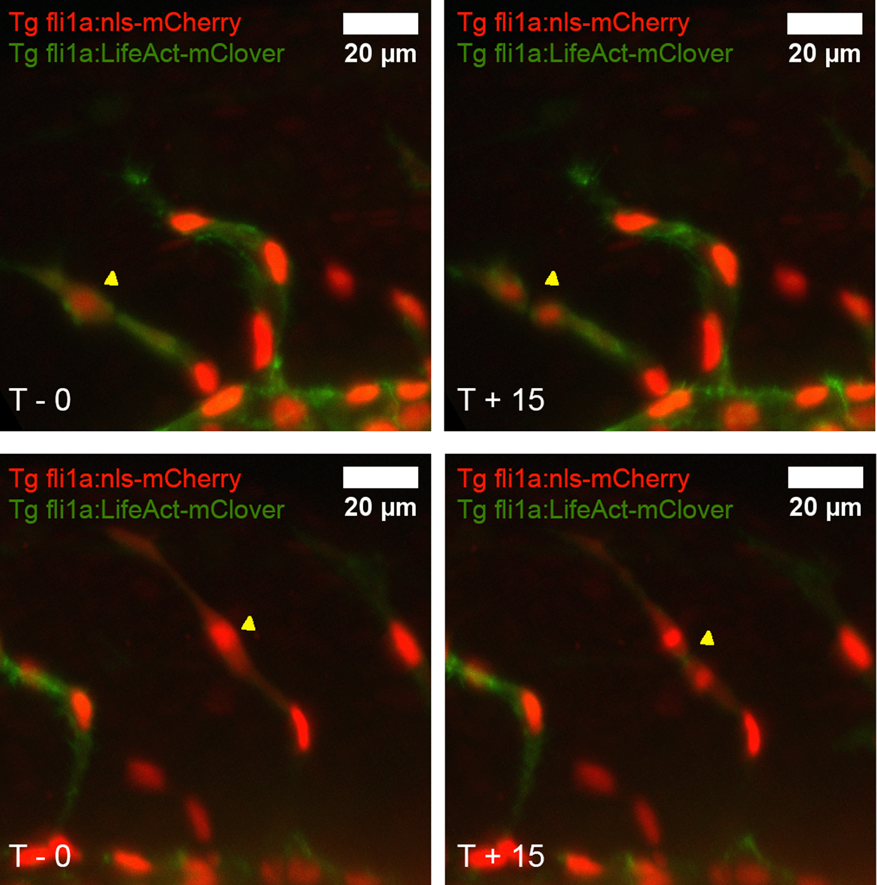 Quantifying endothelial cell proliferation in the... | F1000Research