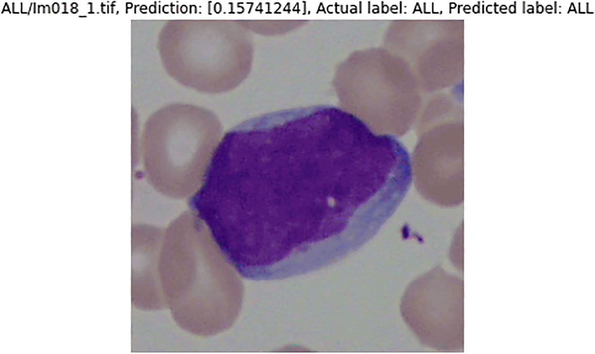WBC-based segmentation and classification on... | F1000Research