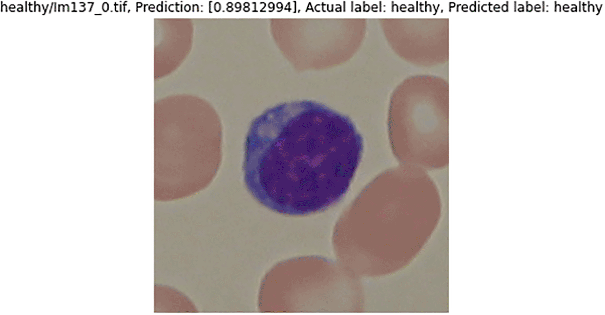 WBC-based segmentation and classification on... | F1000Research
