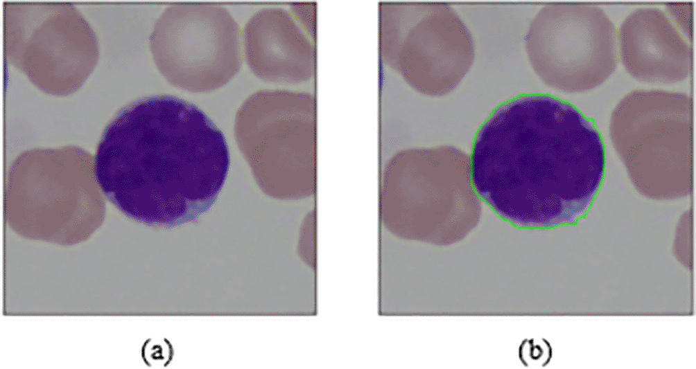 WBC-based segmentation and classification on... | F1000Research