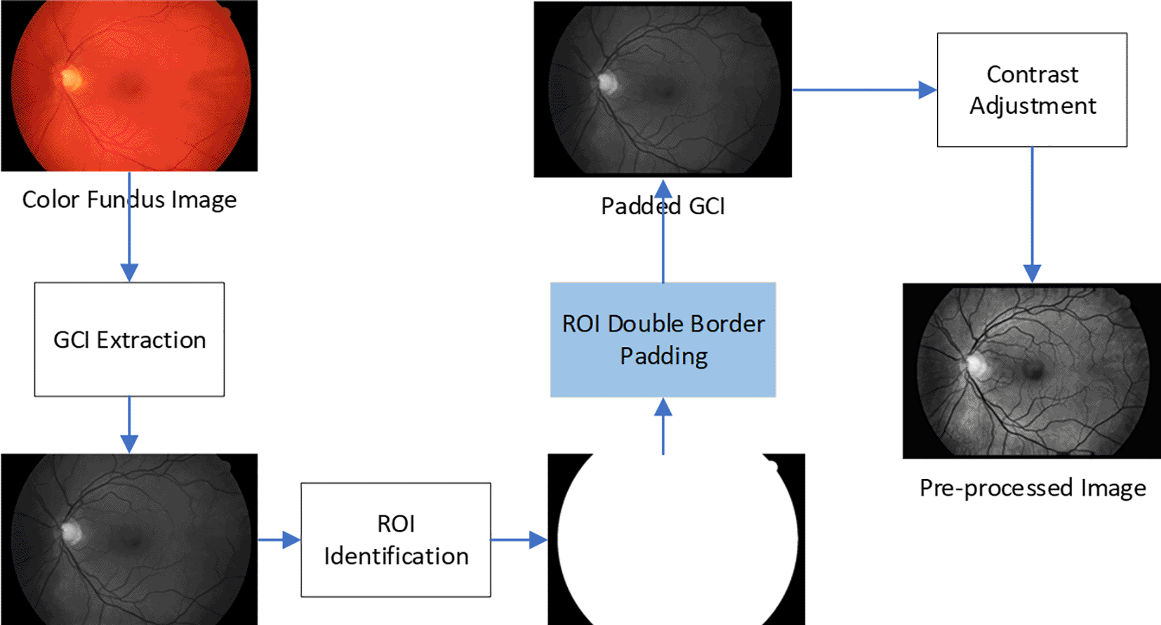 Improved retinal vessel segmentation using the... | F1000Research