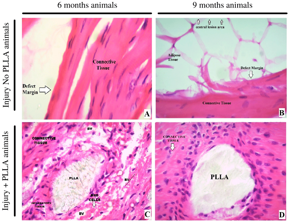 Biological performance of a bioabsorbable Poly... | F1000Research
