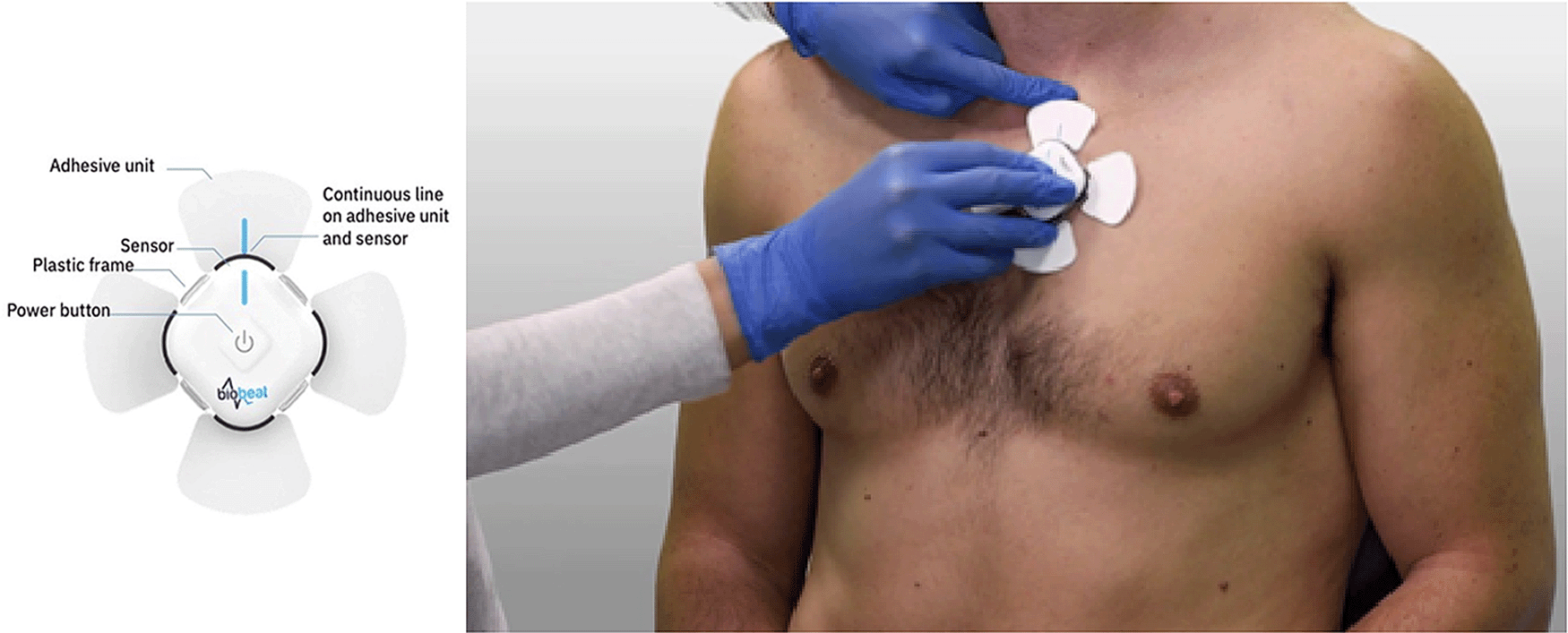 Screening for postoperative vital signs... | F1000Research