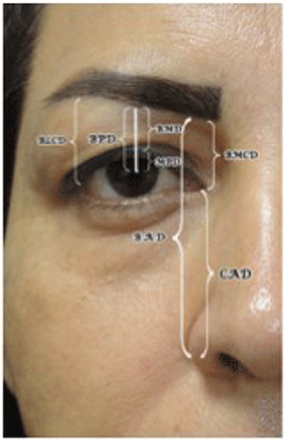 A new minimally invasive, non-excisional,... | F1000Research