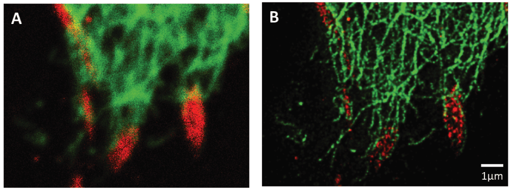 Focusing super resolution on the cytoskeleton | F1000Research