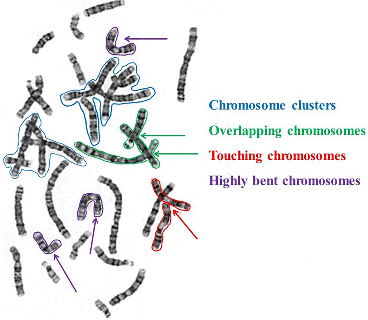 Automated human chromosome segmentation and feature... | F1000Research